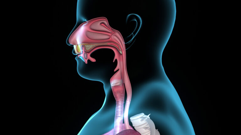 Adenoidite | Drauzio Varella - Drauzio Varella