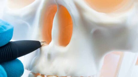 Quando operar o desvio de septo? - Portal Drauzio Varella