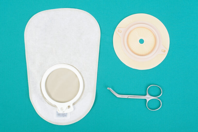Qual a diferença entre ileostomia e colostomia? - Portal Drauzio Varella Qual a diferença entre ileostomia e colostomia? - Portal Drauzio Varella